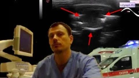 Детское УЗИ костей - Шишка волосистой части головы