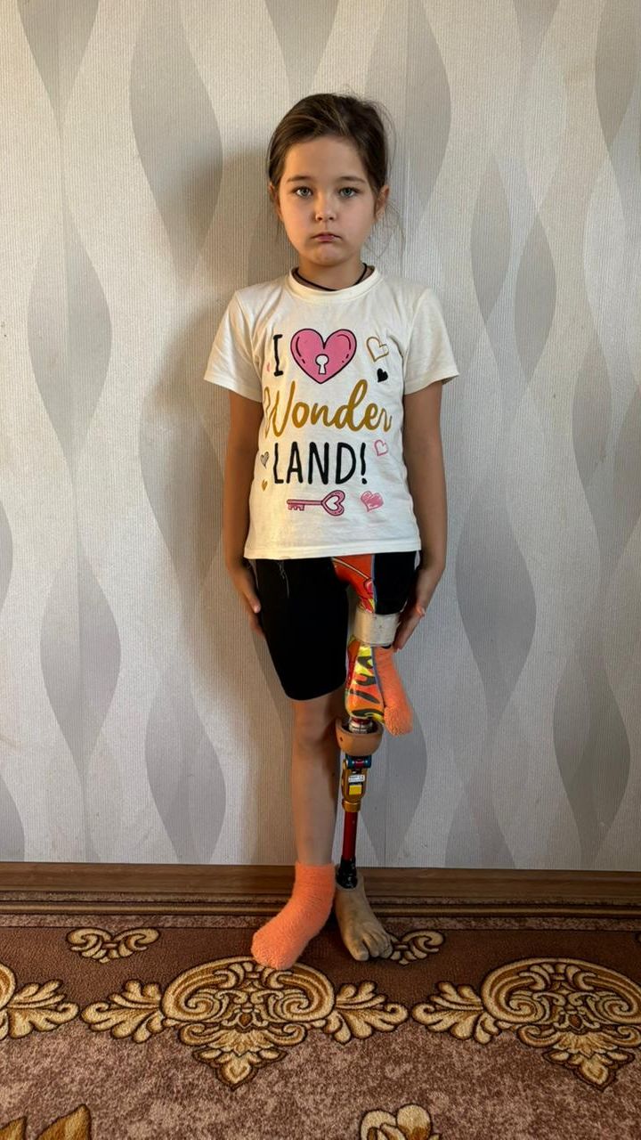 Наташа быстро ходит на кибер ноге