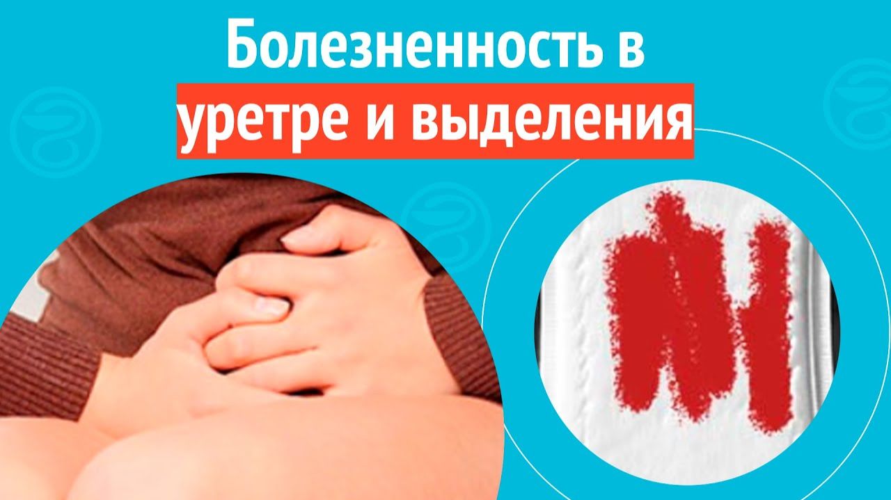 🥹 Болезненность в промежности, уретре и выделения. Клинический случай №1594