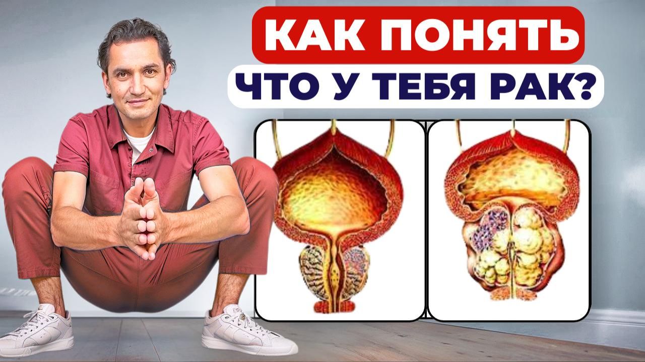 Уролог объясняет: 5 признаков рака простаты, которые легко пропустить!