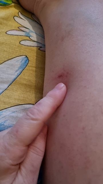 ПОРЧА НА МОМЕНТ СНА , НА МОМЕНТ ОТКЛЮЧЕННОГО СОЗНАНИЯ...