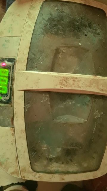 Могут ли после УЗИ появляться боли.