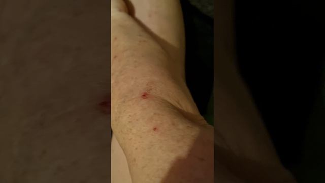 КТО ПРЁТСЯ СО МНОЙ В НОВЫЙ ГОД ПОПАСТЬ ...