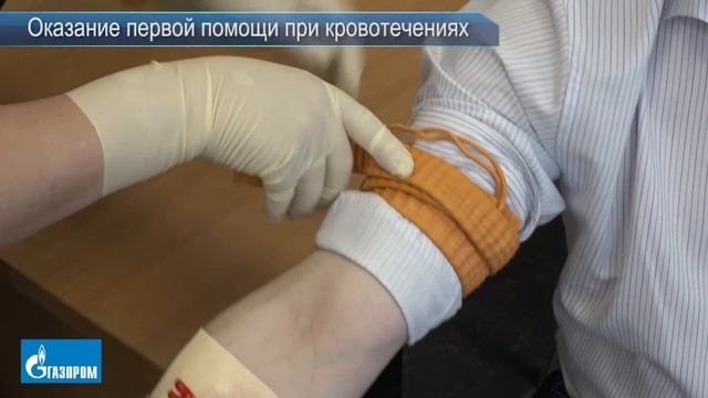 4. Оказание первой помощи при кровотечениях