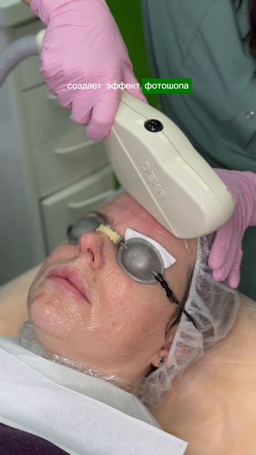 Фотоомоложение: кому показано?