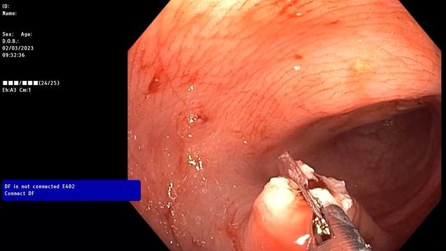 МЫ О НАС - Гастро и колоноскопия