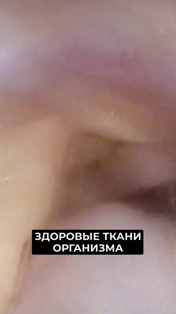 📍Ямальские врачи обучаются инновационным лапароскопическим технологиям #новости #янао