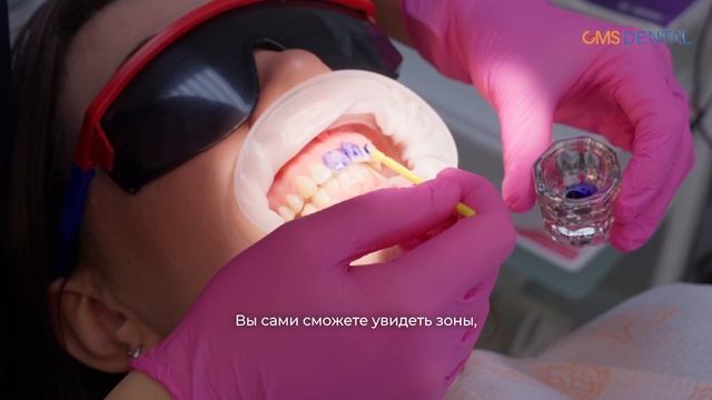 GBT протокол в клинике GMS Dental
