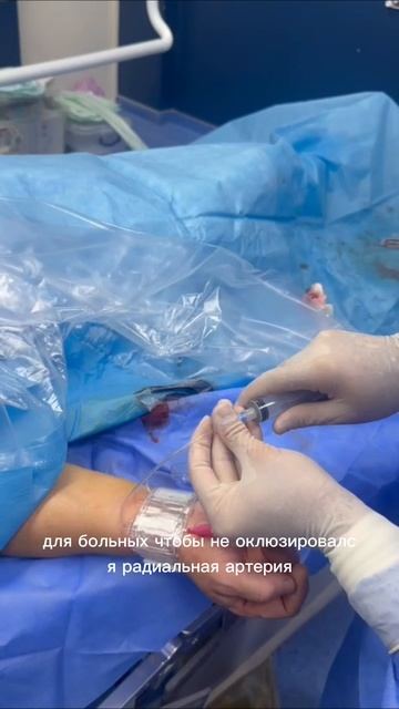 Цивильный гемостаз браслетом Ньюмен после эмболизации миомы матки