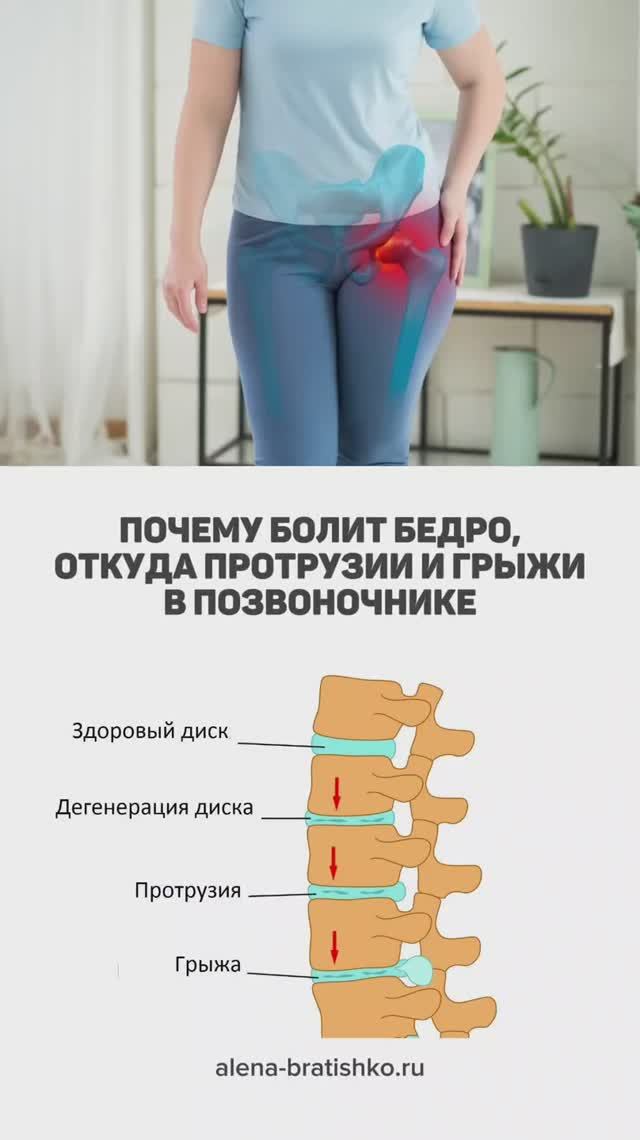 Почему болит бедро так, откуда грыжи и протрузии? Семейный доктор Алена Братишко