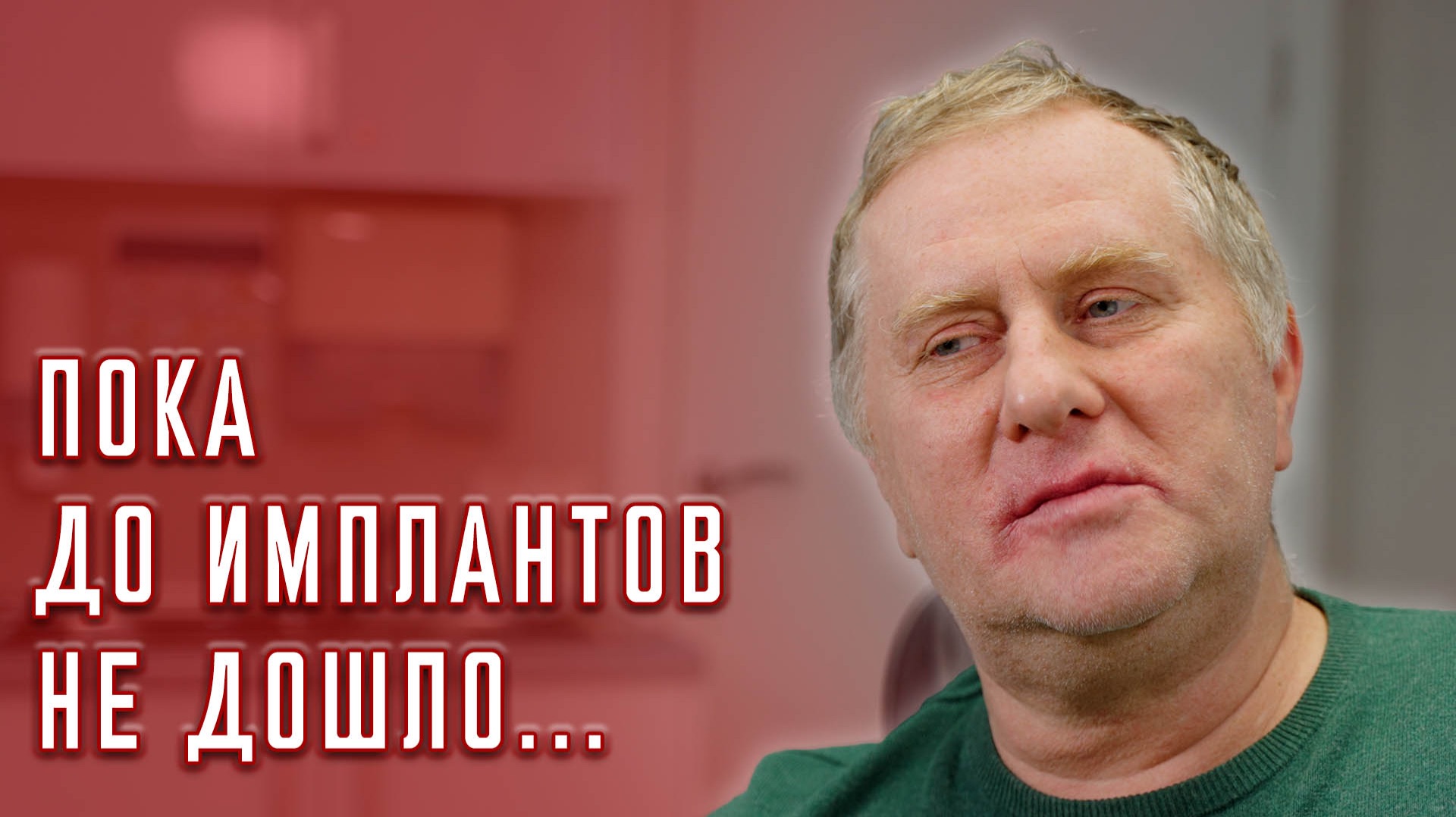 Пациент носит два варианта съемных протезов: Акри Фри и бюгельный. Но хочет себе импланты!