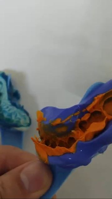 Применение сегментарных ложек для снятия сегментного оттиска.