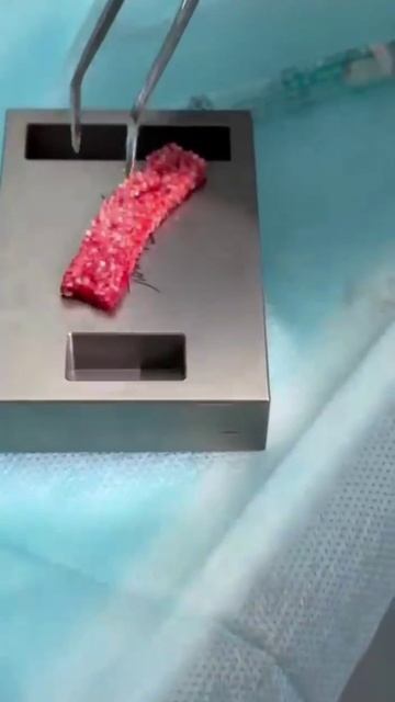 Отзыв о применении компресс-формера доктора Едранова