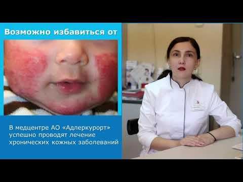 Атопический дерматит: лечение в санатории АО "Адлеркурорт". Врач Югансон Александра Георгиевна