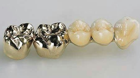 1) .5часов спустя после установки зубов! Новый Сериал. 1 серия. плей лист. После установки!