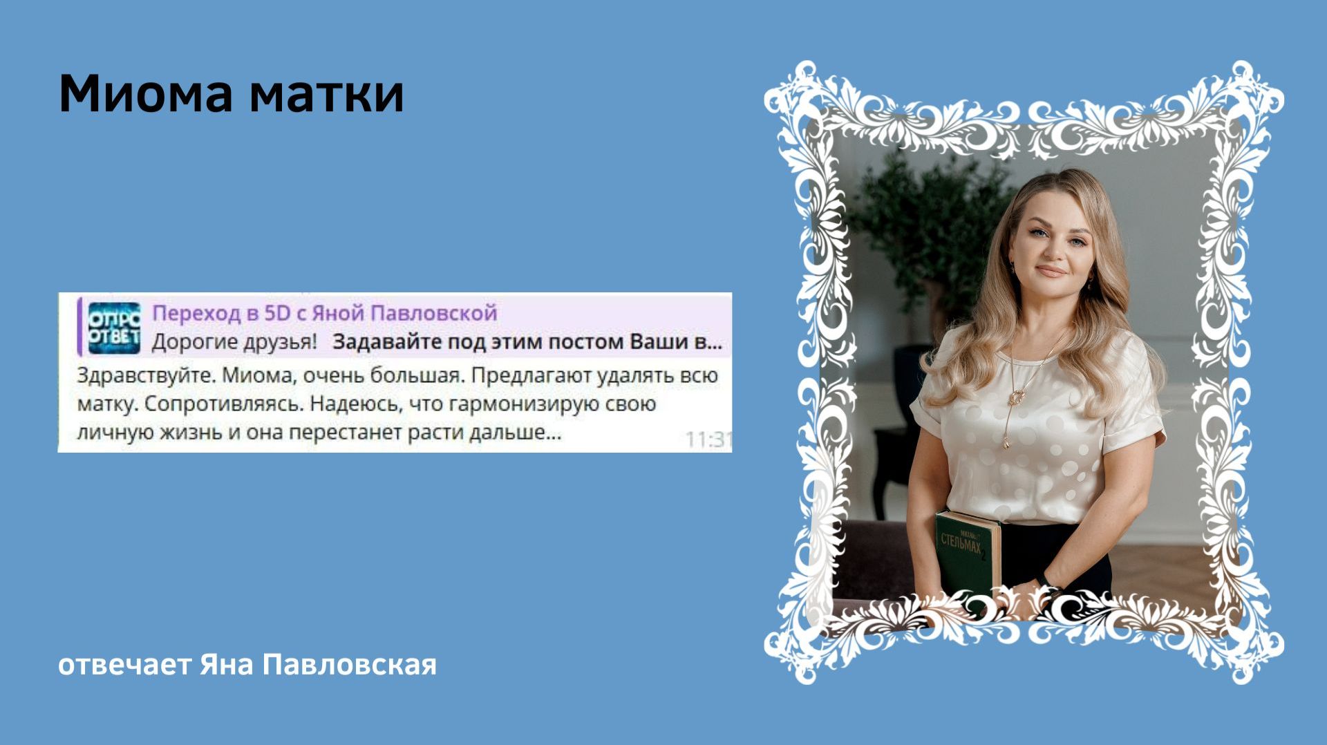 Миома матки | Яна Павловская