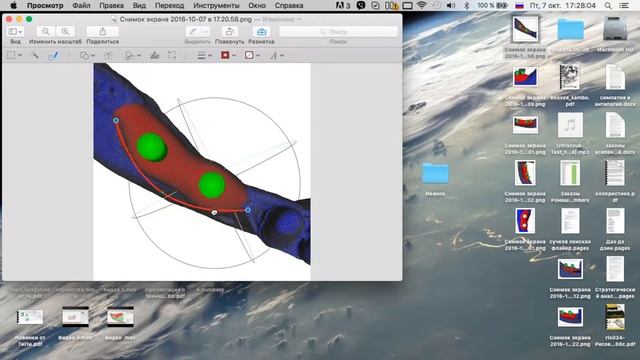 Создание высокоточной трех-мерной модели индивидуаль-ного блока. Часть 7