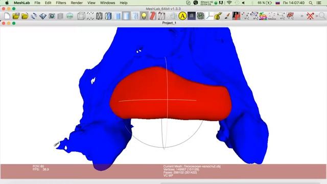 Создание высокоточной трех-мерной модели индивидуаль-ного блока. Часть 17