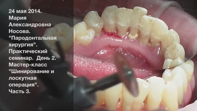 Хирургическое пародонтологическое лечение. Базовый курс. Часть 8