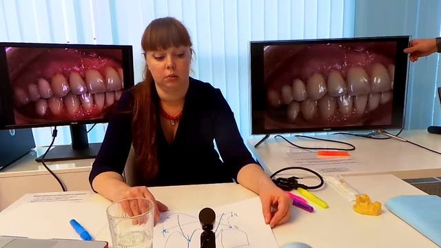 Лечение рецессий десны 10.11.17. Носова Мария. Эпизод 10