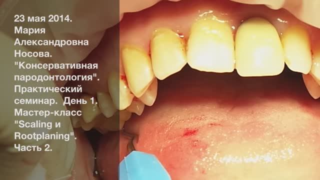 Консервативное пародонтологическое лечение. Базовый курс. Часть 12