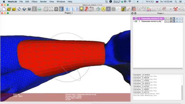 Создание высокоточной трех-мерной модели индивидуаль-ного блока. Часть 18