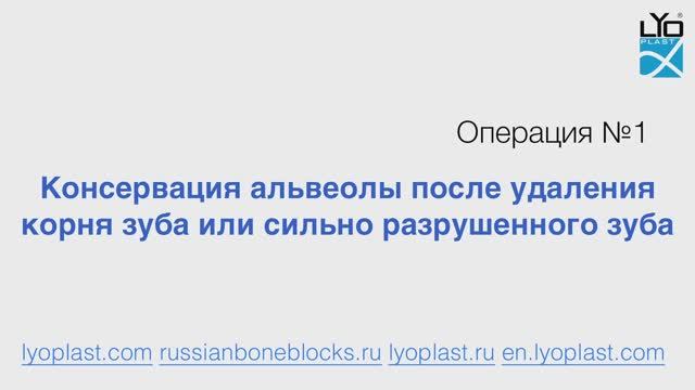 Операция №1 Консервация альвеолы после удаления корня зуба или сильно разрушенного зуба