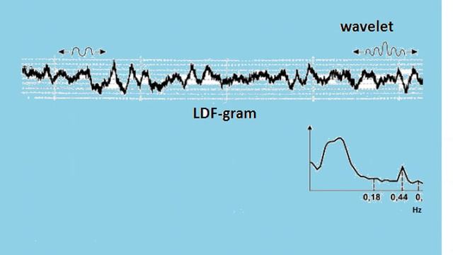 Laser Doppler flowmetry. A methodological complex for the evaluation of periodontal microcirculation