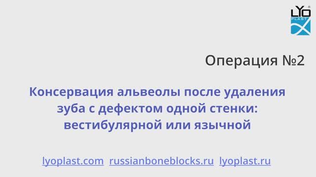 Операция №2 Консервация альвеолы после удаления зуба с дефектом одной стенки