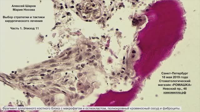Выбор стратегии и тактики лечения 1.11