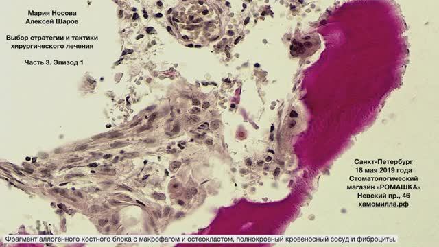 Выбор стратегии и тактики лечения 3.1
