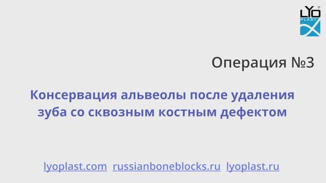 Операция №3 Консервация альвеолы после удаления зуба со сквозным костным дефектом