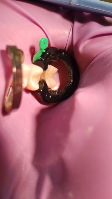 Установка матричного кольца Runa dent black.