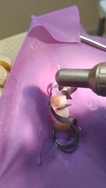 Абразивная отработка поверхности 21 зуба оксидом алюминия 30 мкм.