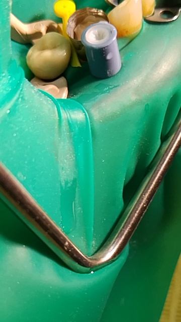 Установка матричной системы Super mat Kerr Have на 45 зуб.