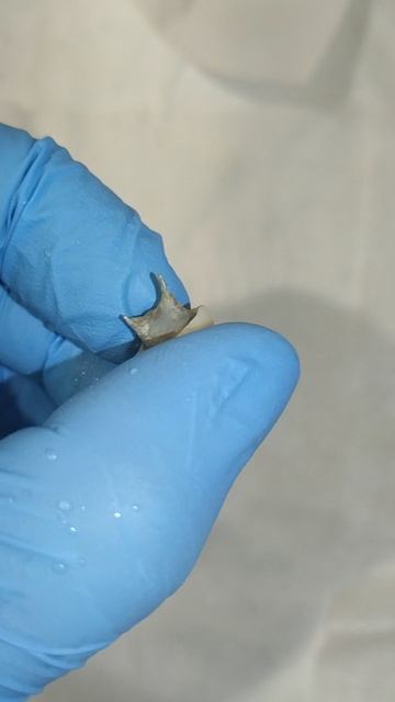 Выпадение 16 с опорой на культовой вкладке.