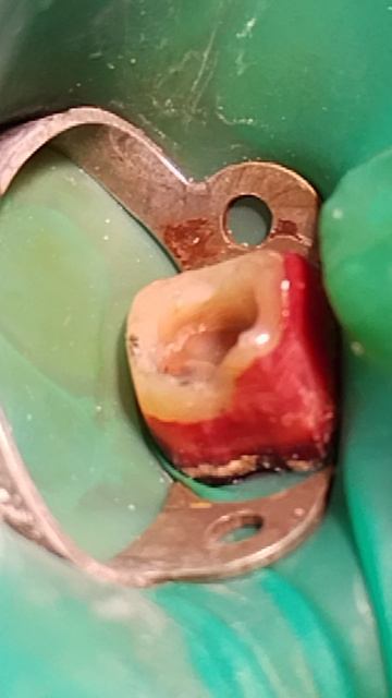 Русский резорцин (red russian cement)#1.