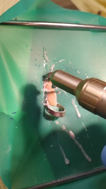 Абразивная отработка поверхности 21 зуба оксидом алюминия 50 мкм.