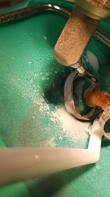 Абразивная отработка поверхности зуба 33 оксидом алюминия 30 мкм.