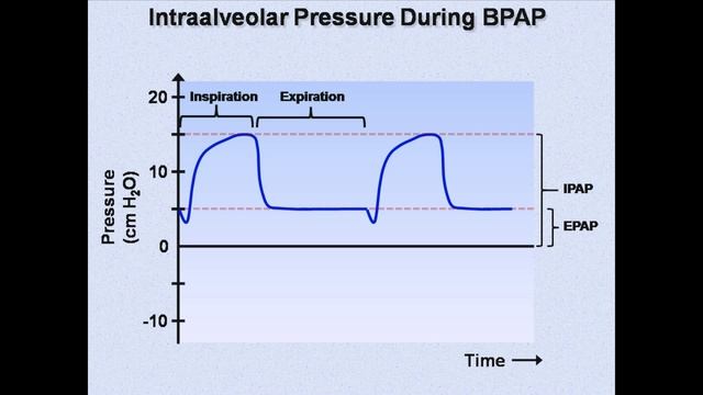 6_Non-Invasive Positive Pressure Ventilation (Mech Vent- Lecture 6) Eric Strong