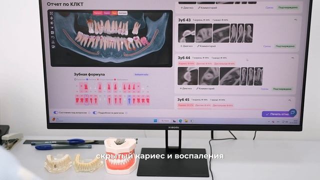 Стоматология Антика.Использование ИИ в нашей клинике