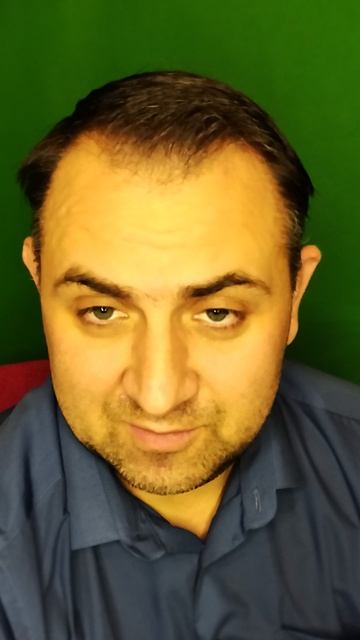 Мерфизмы в стоматологии 13. Острая боль в пятницу вечером.