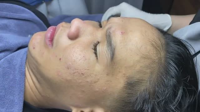 Relax Acne 008 • АСМР • Loan Nguyen collection