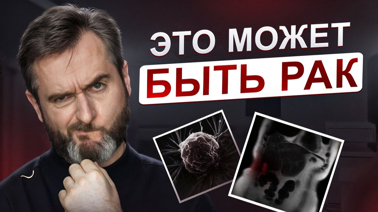 3 тревожных симптома рака, которые не стоит игнорировать!