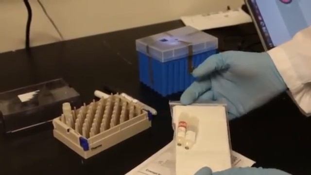 ИИ расшифровал ДНК 0 группы крови, результат поразил мир