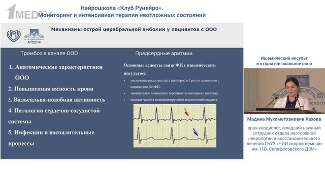 Ишемический инсульт и открытое овальное окно Хахова М.М. 2025