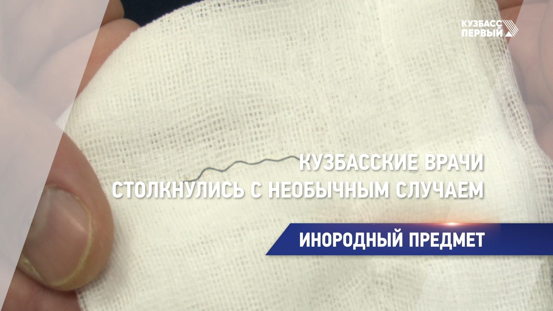 Инородный предмет