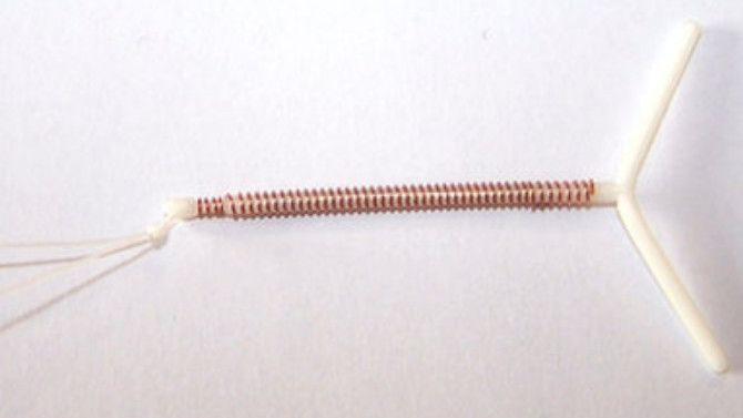 Спираль противозачаточная