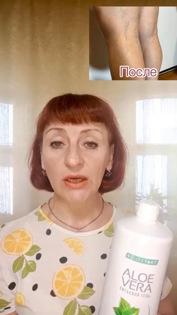 Варикозное расширение вен