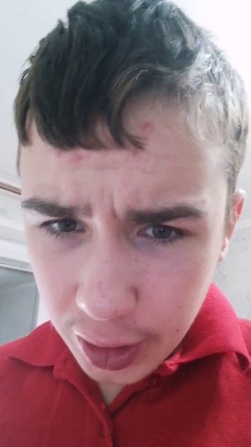 наш клоун умер😭😭😥часть 9